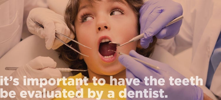 Can a Loose Baby Tooth Reattach Itself? | Smile Generation